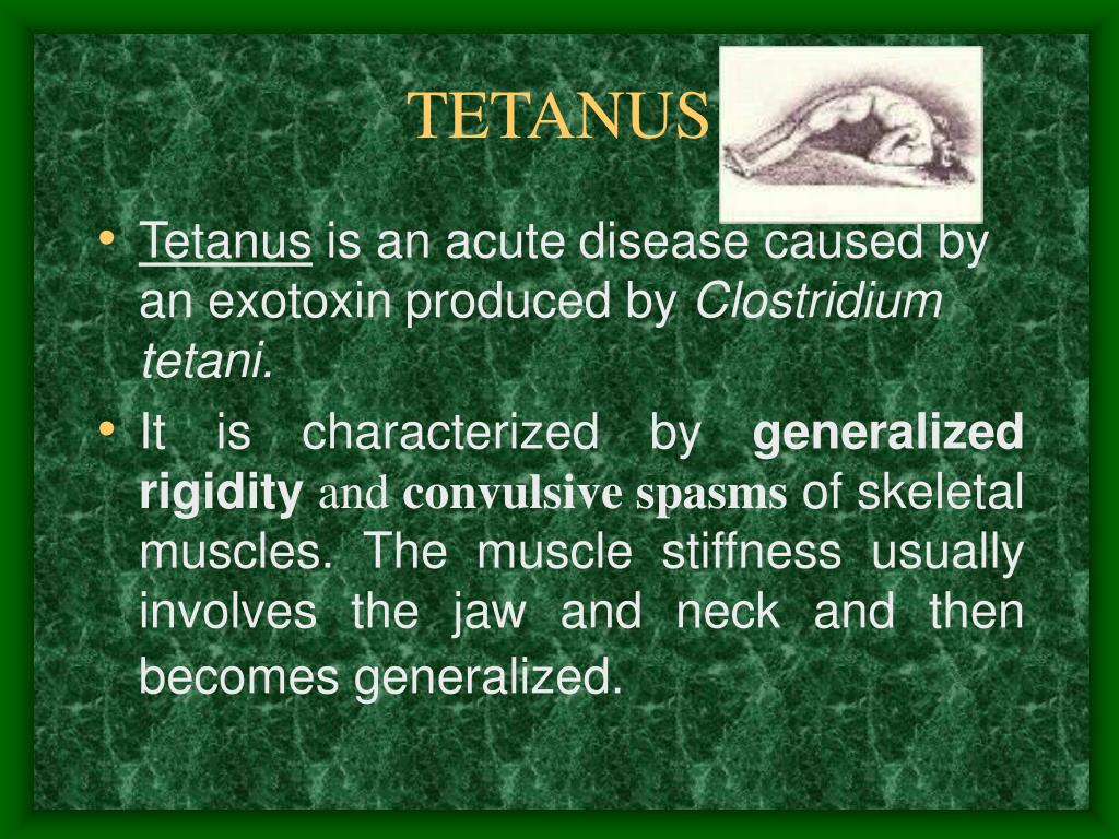 PPT - TETANUS PowerPoint Presentation, free download - ID:3653569