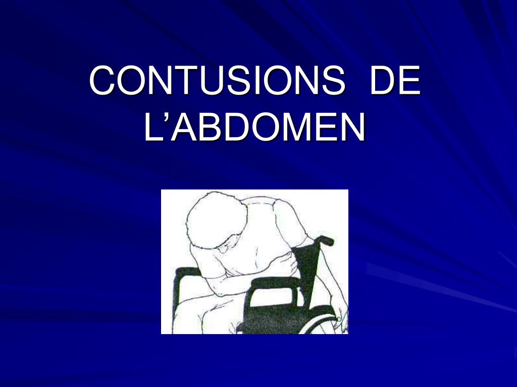 PPT - CONTUSIONS DE L’ABDOMEN PowerPoint Presentation, free download ...