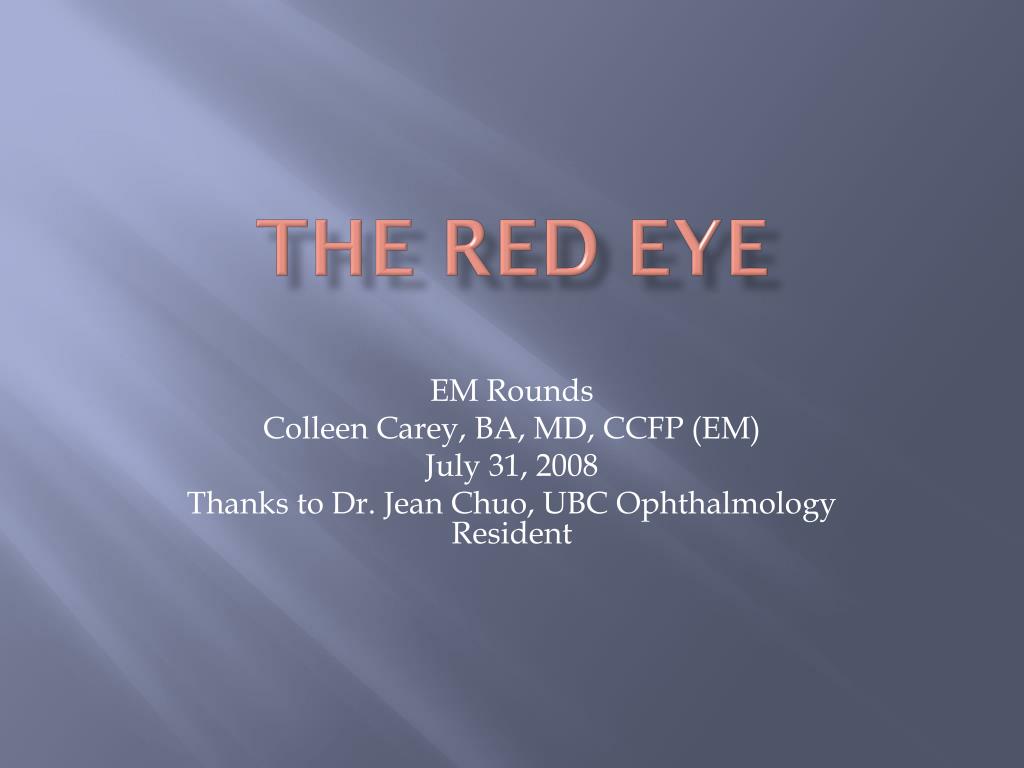 PPT - The Red Eye PowerPoint Presentation, free download - ID:3721354