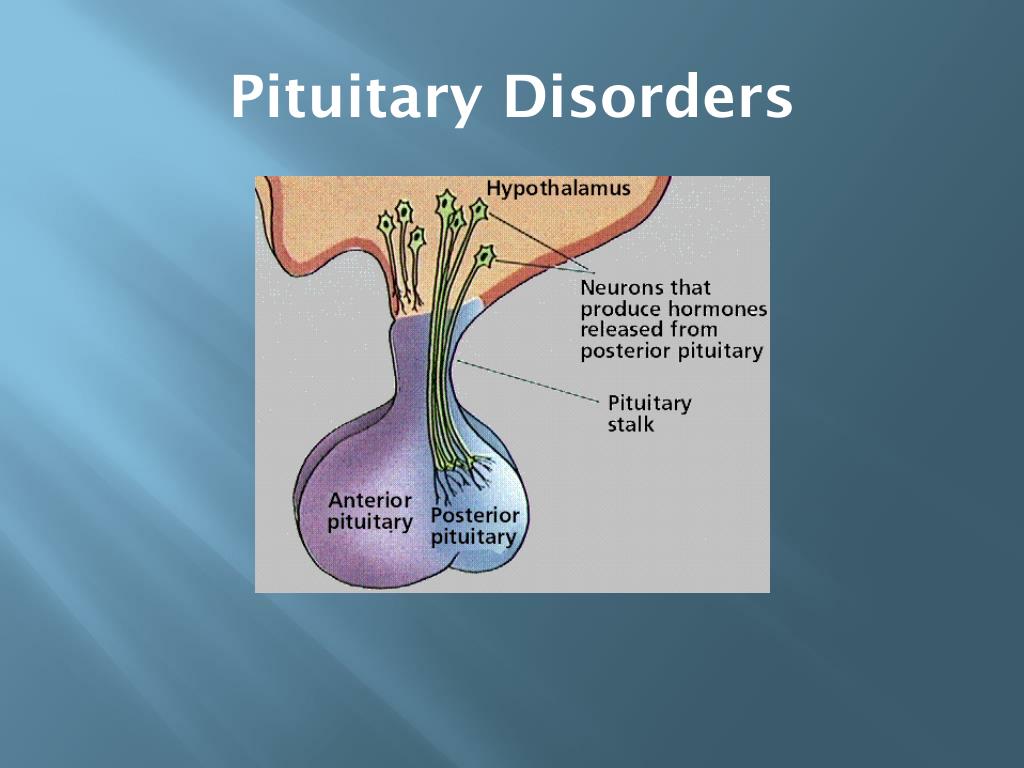 PPT - Pituitary Disorders PowerPoint Presentation, free download - ID ...