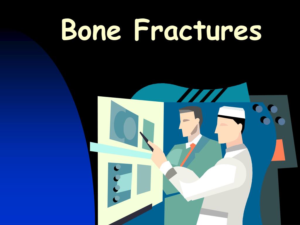 PPT - Bone Fractures PowerPoint Presentation, free download - ID:3790020