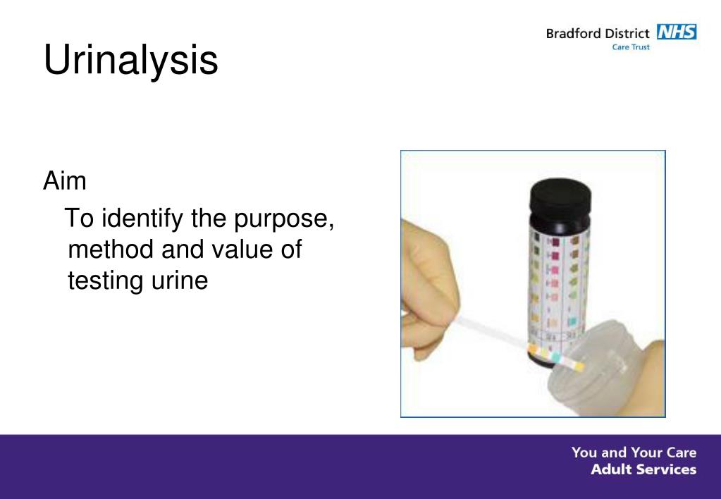 PPT - Urinalysis PowerPoint Presentation, free download - ID:3812917