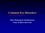 PPT - Disorders of the Eye PowerPoint Presentation, free download - ID ...