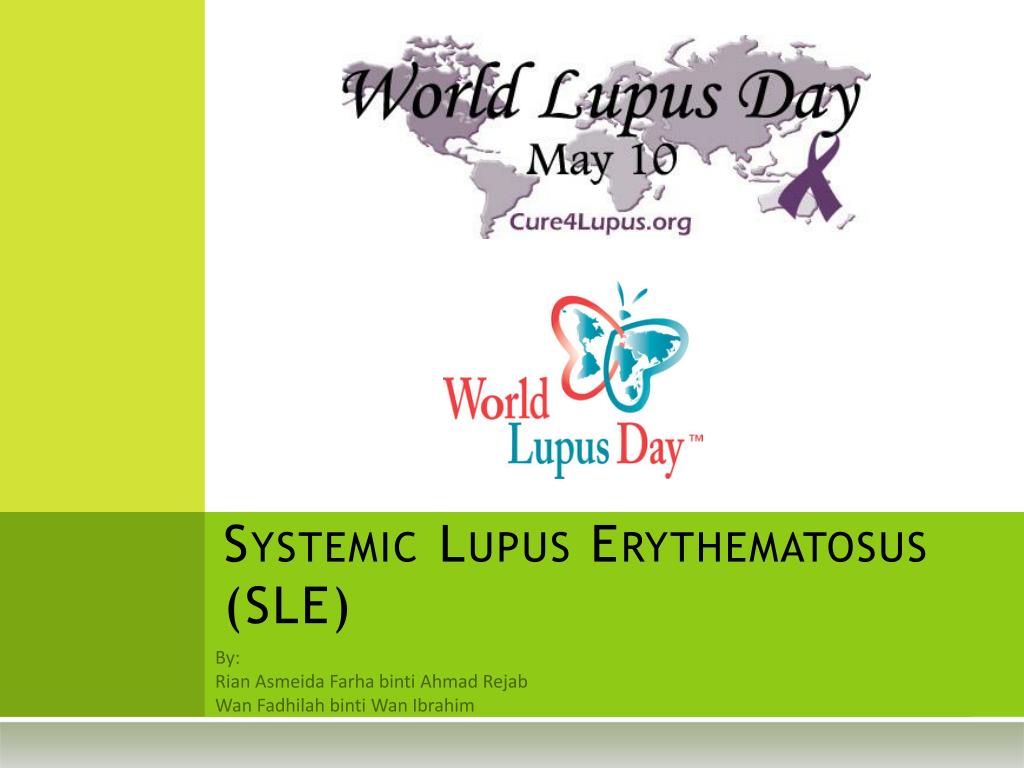 PPT - Systemic Lupus Erythematosus (SLE) PowerPoint Presentation, free ...