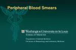 PPT - Blood draws from Peripheral Catheters PowerPoint Presentation ...