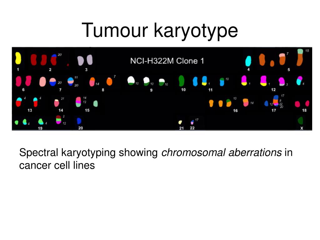PPT - Tumour karyotype PowerPoint Presentation, free download - ID:3994079