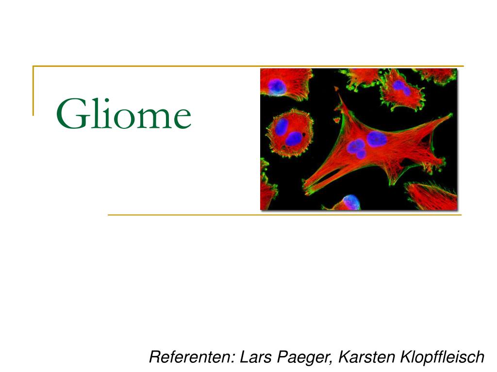 PPT - Gliome PowerPoint Presentation, free download - ID:4022609