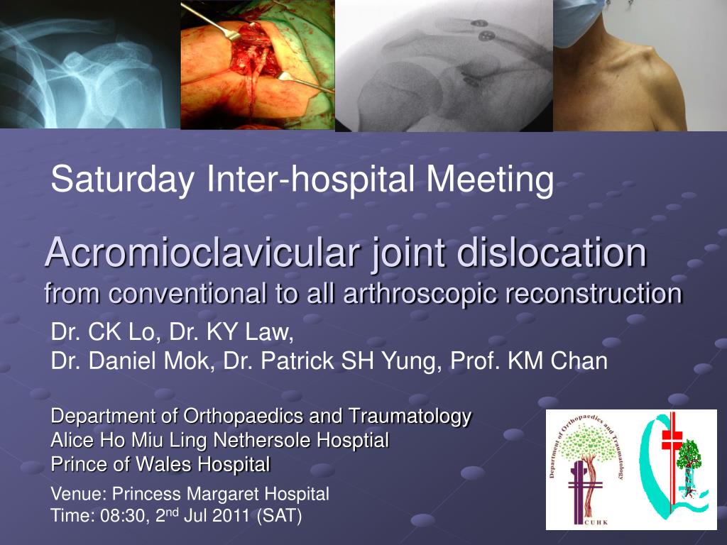 PPT - Acromioclavicular joint dislocation from conventional to all ...