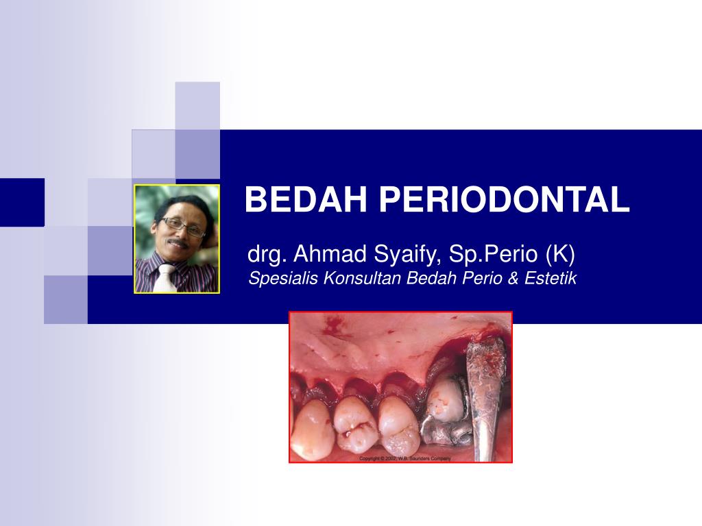 PPT - BEDAH PERIODONTAL PowerPoint Presentation, free download - ID:4069631