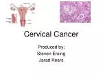 PPT - CERVICAL CANCER PowerPoint Presentation, free download - ID:3370427