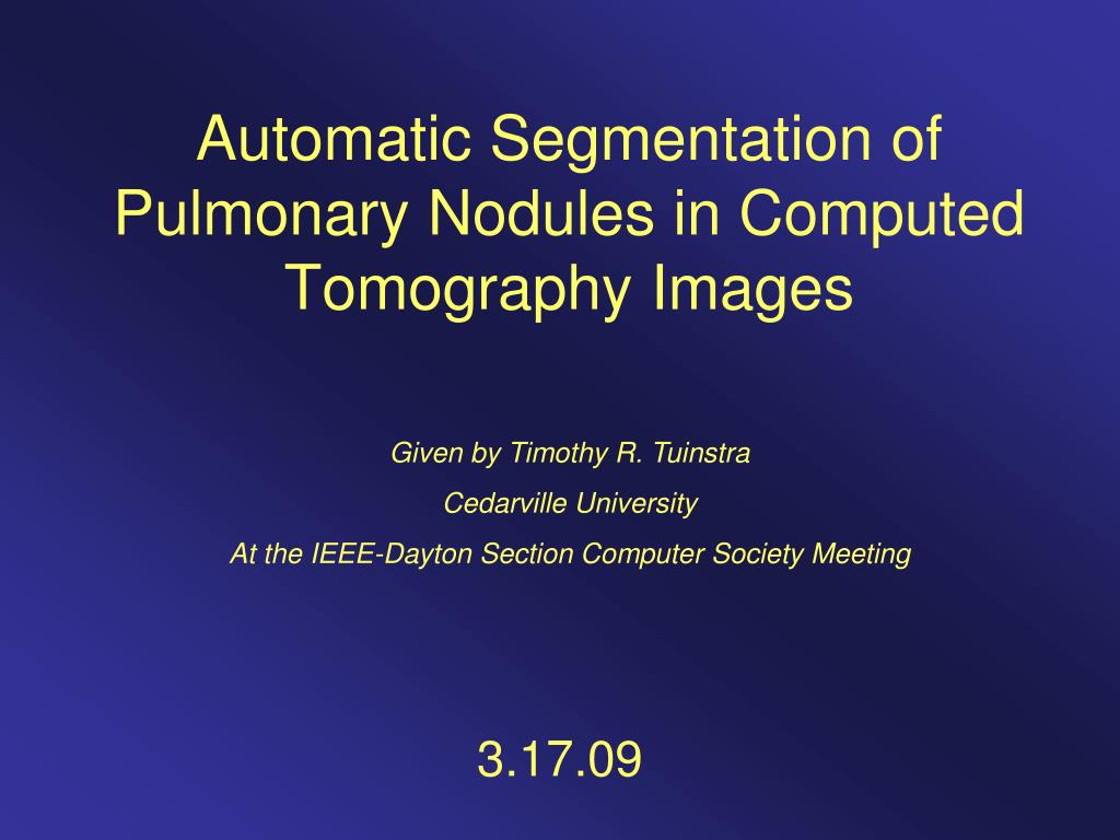 Ppt Automatic Segmentation Of Pulmonary Nodules In Computed Tomography Images Powerpoint