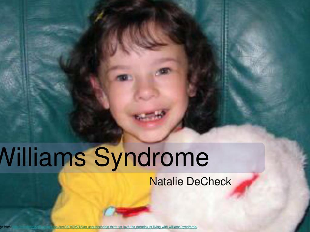 PPT - Williams Syndrome PowerPoint Presentation, free download - ID:4195454