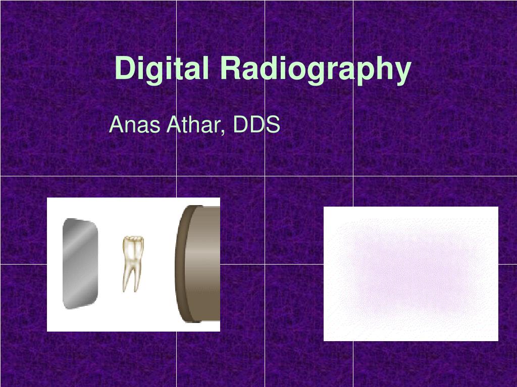 PPT - Digital Radiography PowerPoint Presentation, free download - ID ...