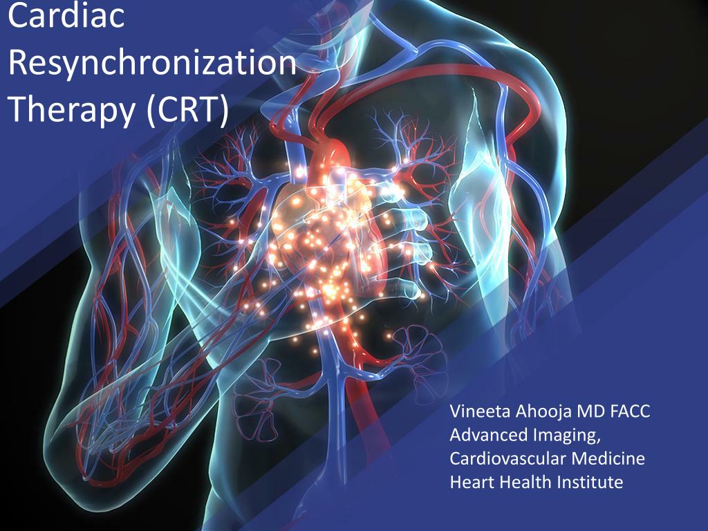 PPT - Cardiac Resynchronization Therapy (CRT) PowerPoint Presentation, free download - ID:4232185