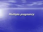 PPT - 多胎妊娠 Multiple Pregnancy PowerPoint Presentation, free download ...