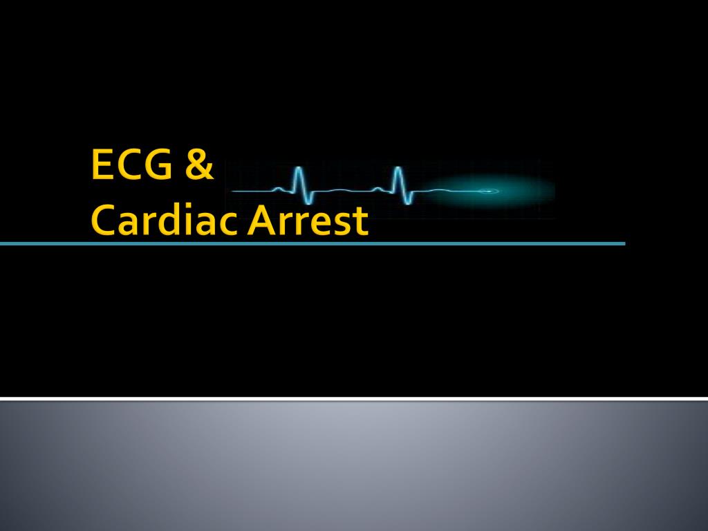 PPT - ECG & Cardiac Arrest PowerPoint Presentation, free download - ID ...