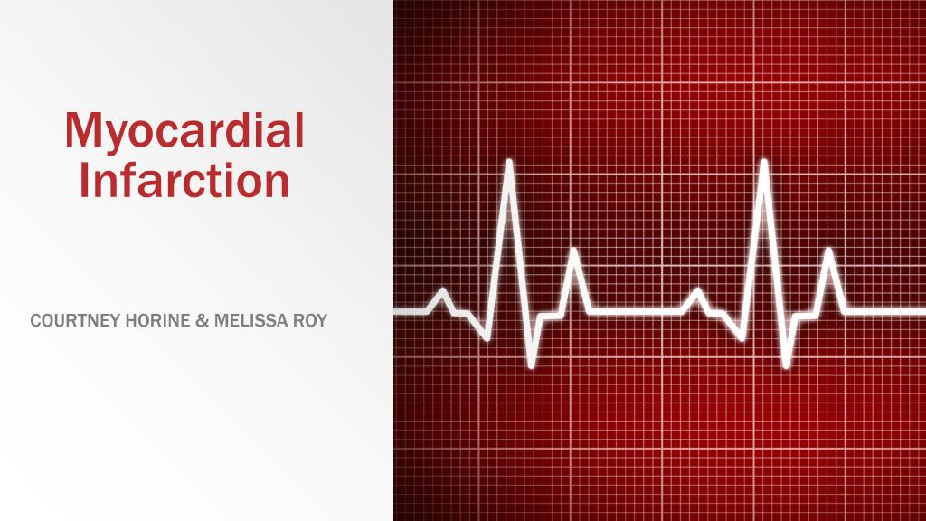 PPT - Myocardial Infarction PowerPoint Presentation, free download - ID ...