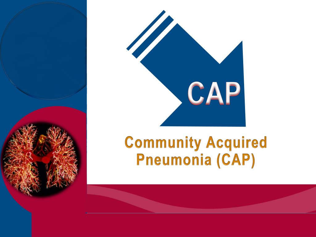 PPT - Community Acquired Pneumonia (CAP) PowerPoint Presentation, free ...