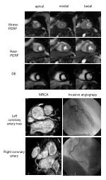 PPT - APICAL SURFACE MODIFICATIONS OF THE CELL PowerPoint Presentation ...
