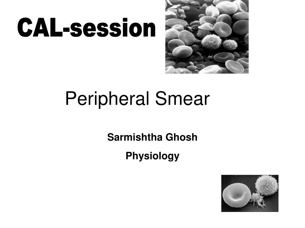 PPT - Peripheral Smear PowerPoint Presentation, free download - ID:4385589