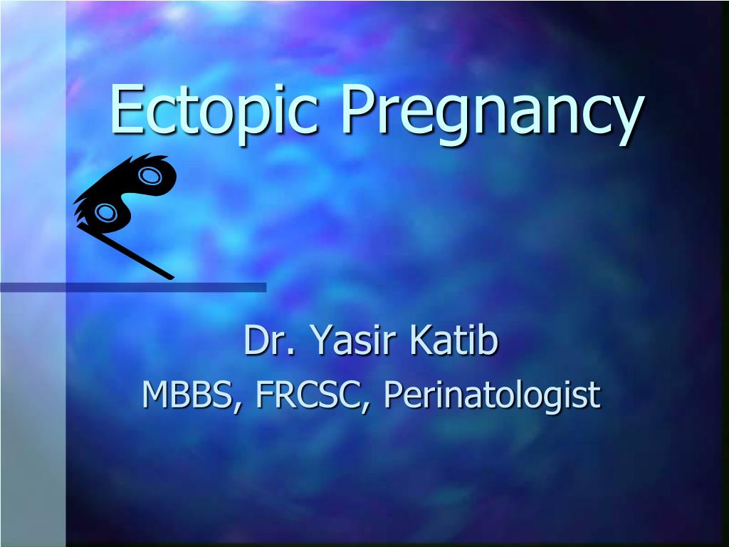 PPT - Ectopic Pregnancy PowerPoint Presentation, free download - ID:4389505
