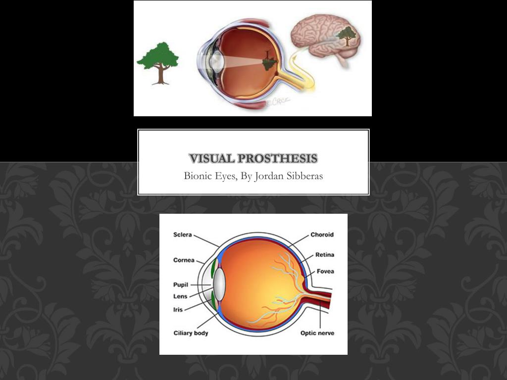 PPT - Visual prosthesis PowerPoint Presentation, free download - ID:4410221