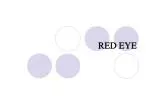 PPT - RED EYE PowerPoint Presentation, free download - ID:4462254