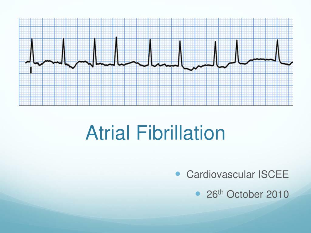 PPT - Atrial Fibrillation PowerPoint Presentation, free download - ID ...