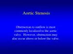 PPT - Aortic Stenosis PowerPoint Presentation, free download - ID:157153