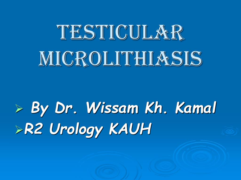 PPT - Testicular microlithiasis PowerPoint Presentation, free download ...
