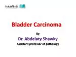 PPT - Bladder Exstrophy PowerPoint Presentation, free download - ID:7932163