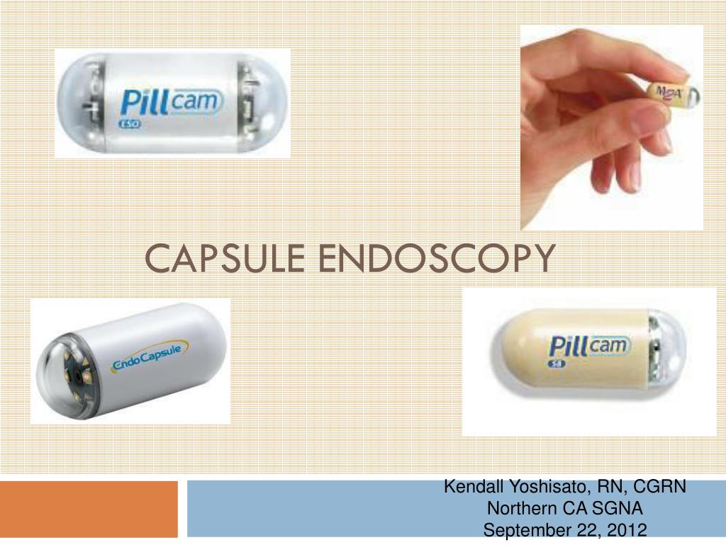 PPT - Capsule Endoscopy PowerPoint Presentation, free download - ID:4521276