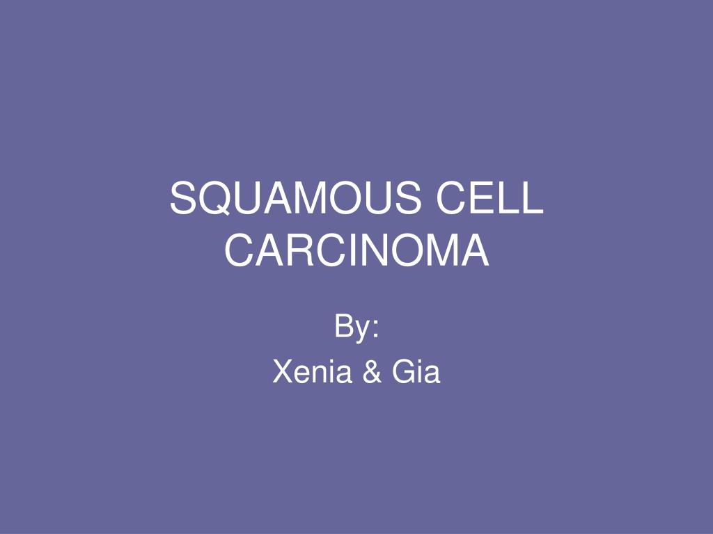 PPT - SQUAMOUS CELL CARCINOMA PowerPoint Presentation, free download ...