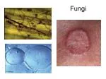 PPT - REGNUL FUNGI PowerPoint Presentation, free download - ID:3528682