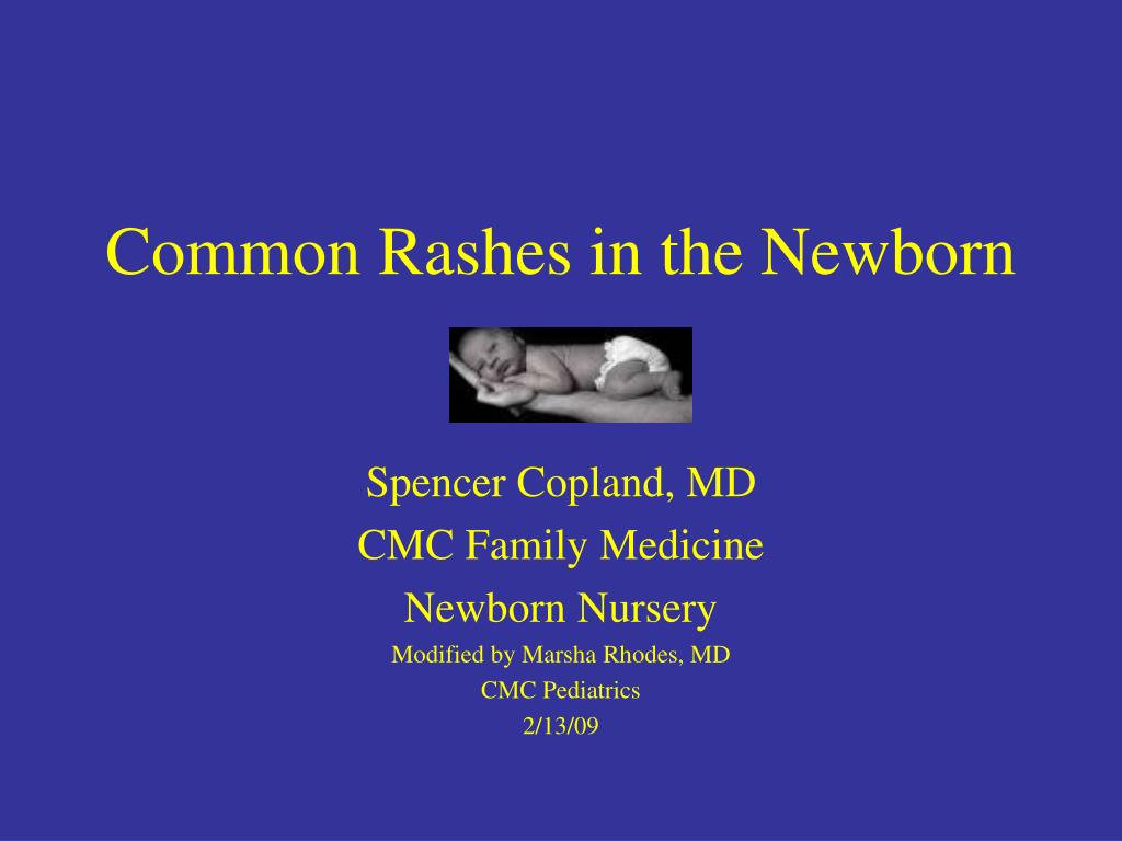 PPT - Common Rashes in the Newborn PowerPoint Presentation, free ...