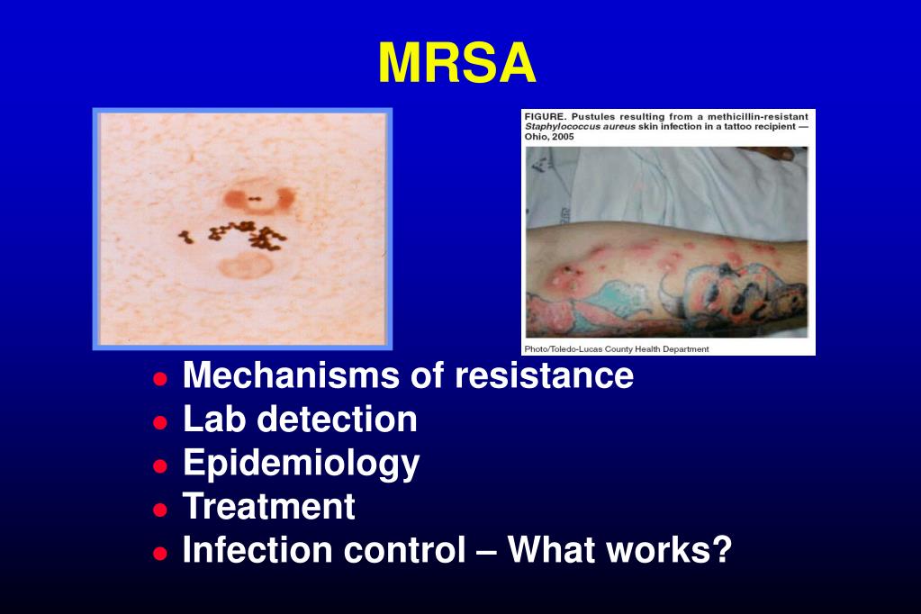 PPT - MRSA PowerPoint Presentation, free download - ID:4567435