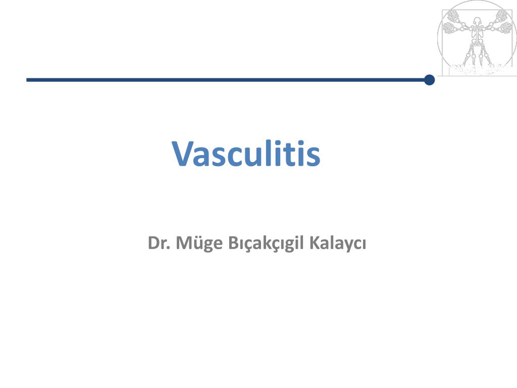 PPT - Vasculitis PowerPoint Presentation, free download - ID:4571797