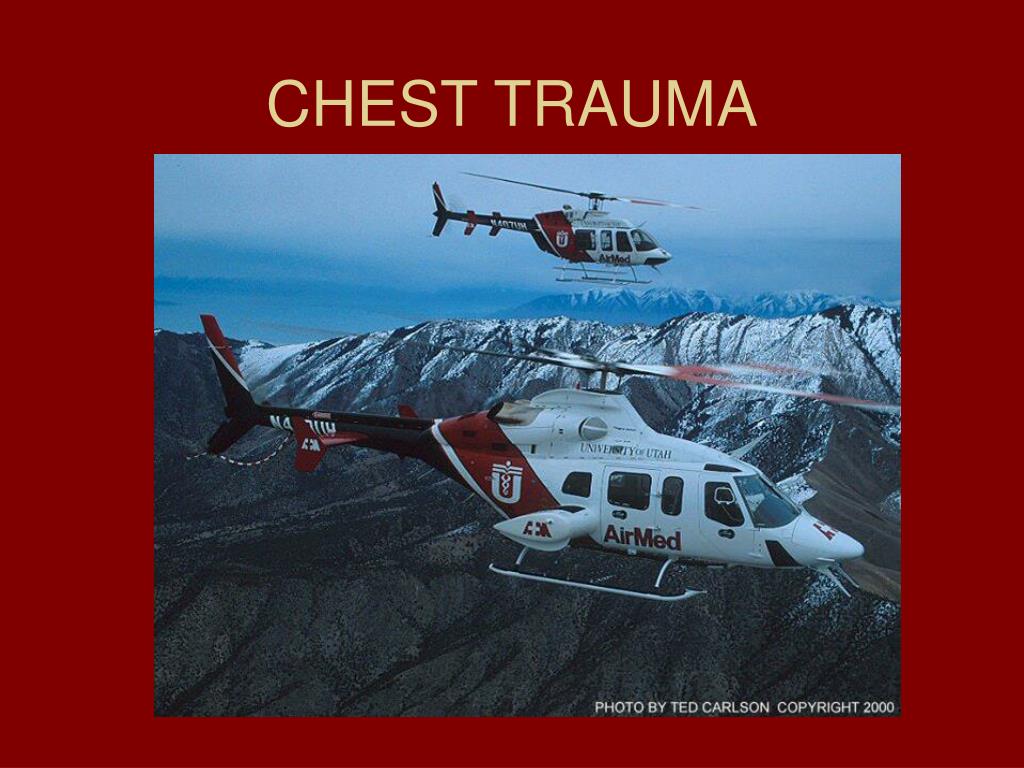 PPT - CHEST TRAUMA PowerPoint Presentation, free download - ID:4611815