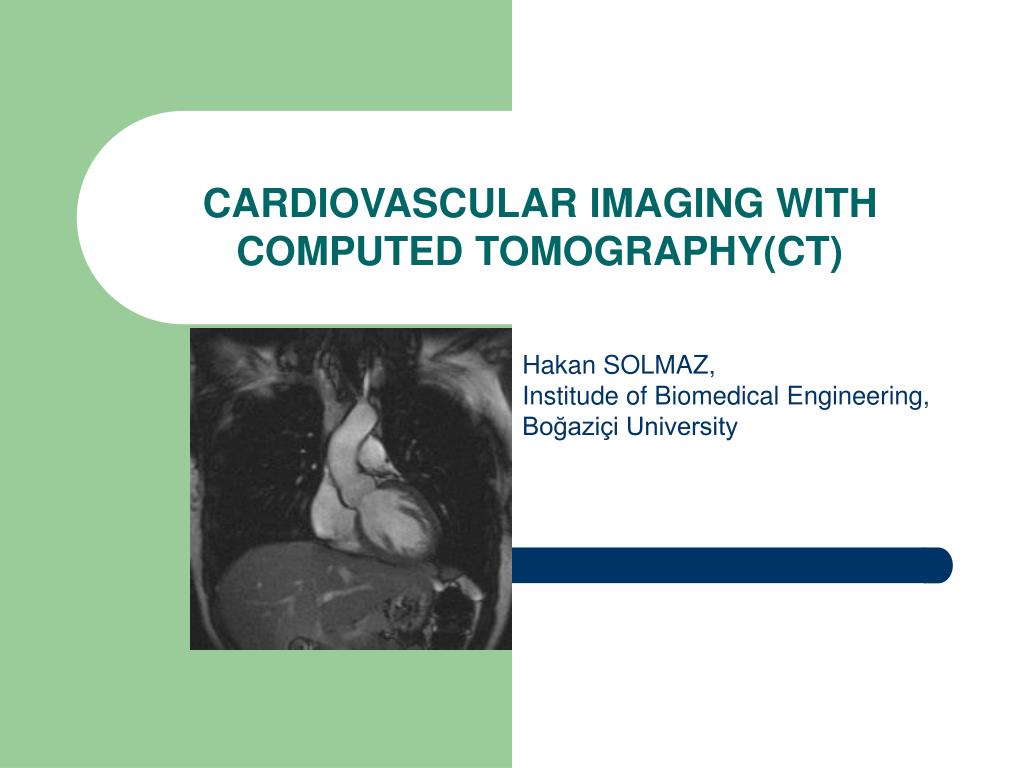 PPT - CARDIOVASCULAR IMAGING WITH COMPUTED TOMOGRAPHY(CT) PowerPoint ...