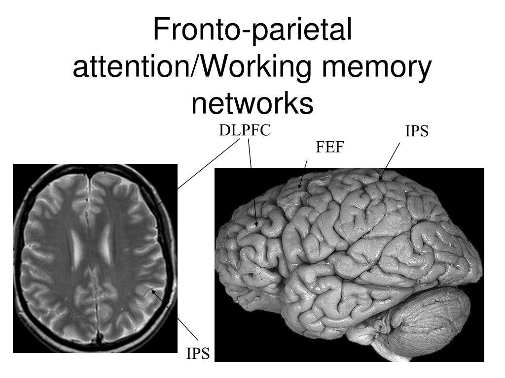 PPT - Fronto-parietal attention/Working memory networks PowerPoint ...