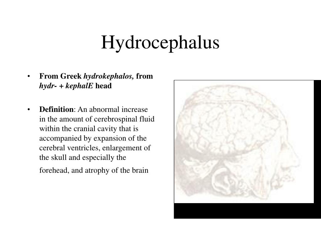 PPT - Hydrocephalus PowerPoint Presentation, free download - ID:4628530