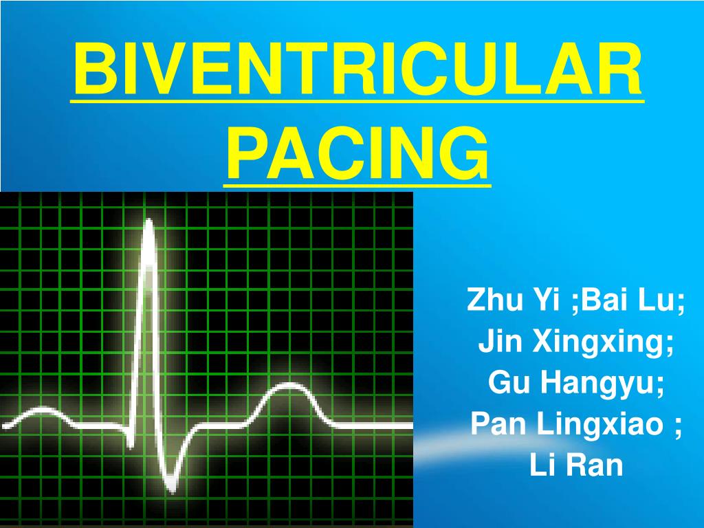 PPT - BIVENTRICULAR PACING PowerPoint Presentation, free download - ID ...