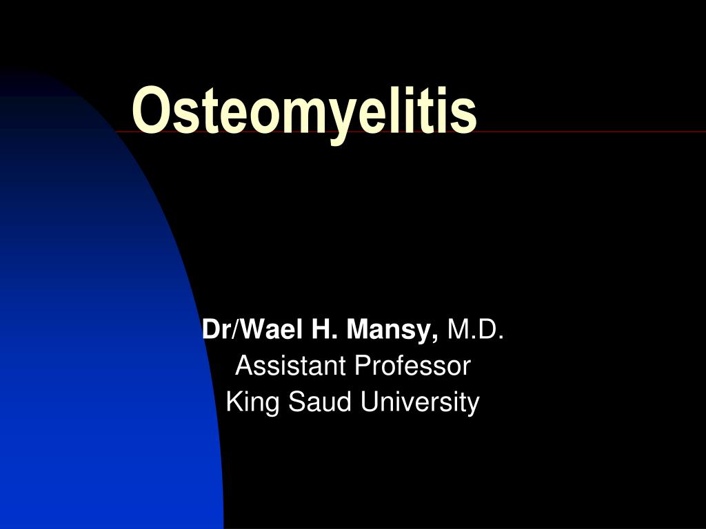 PPT - Osteomyelitis PowerPoint Presentation, free download - ID:4656555