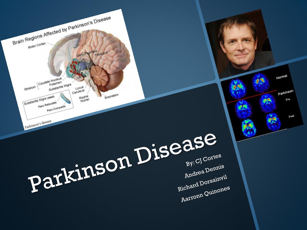 PPT - Parkinson Disease PowerPoint Presentation, free download - ID:4666711