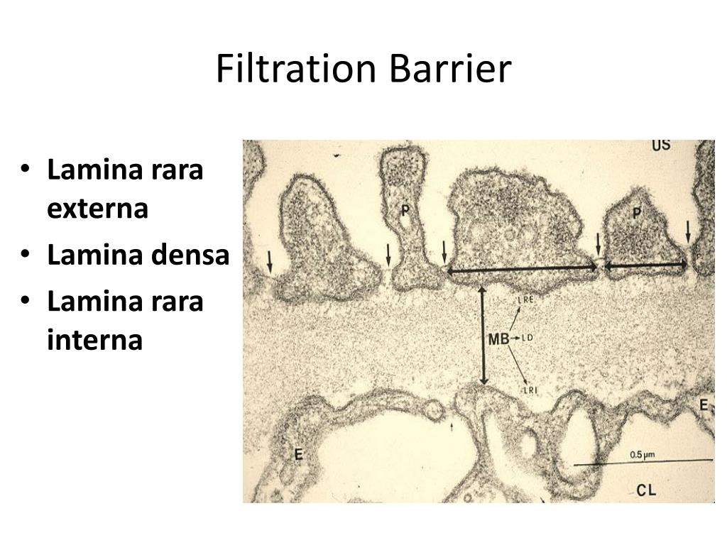 PPT - Filtration Barrier PowerPoint Presentation, free download - ID ...