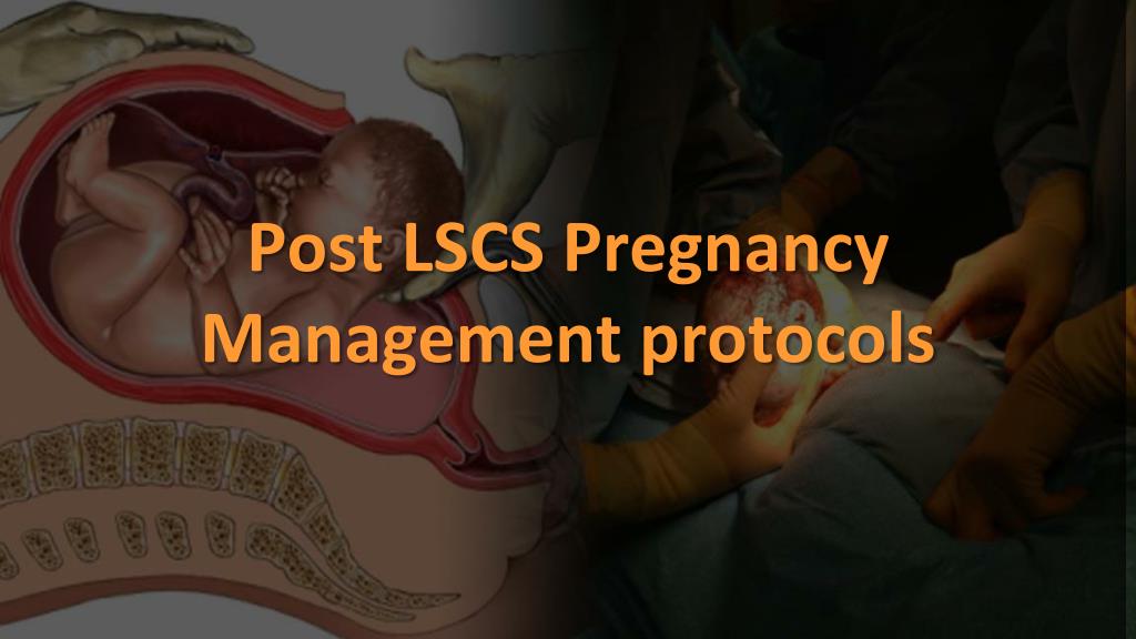 PPT - Post LSCS Pregnancy Management protocols PowerPoint Presentation ...