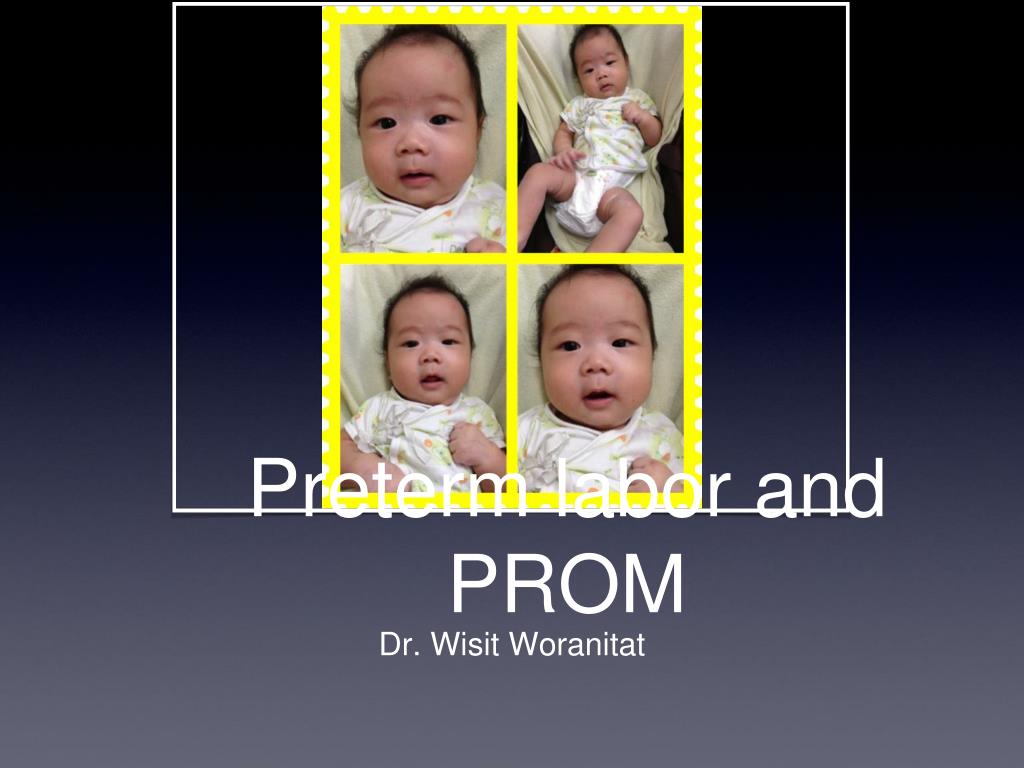 PPT - Preterm labor and PROM PowerPoint Presentation, free download ...