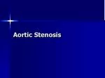 PPT - Aortic Stenosis and TAVR PowerPoint Presentation, free download ...