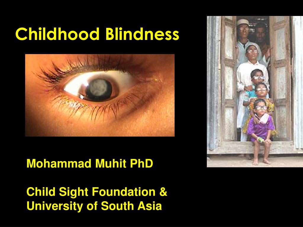 PPT - Childhood Blindness PowerPoint Presentation, free download - ID ...