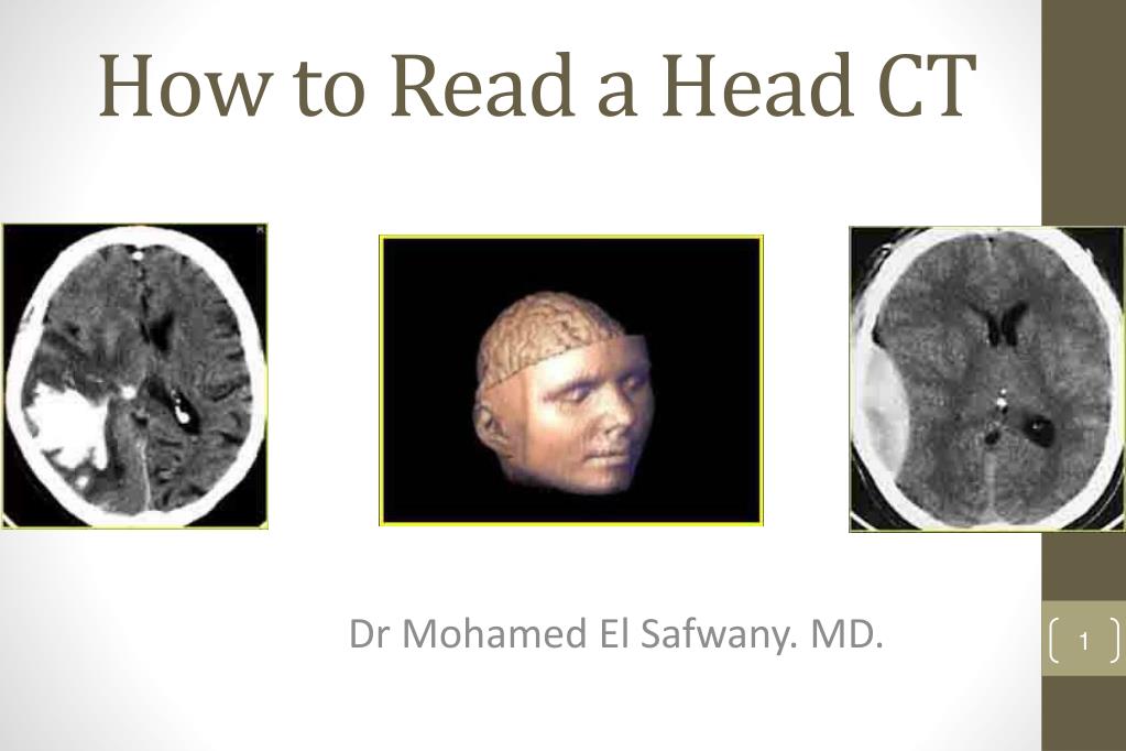 PPT - How to Read a Head CT PowerPoint Presentation, free download - ID ...